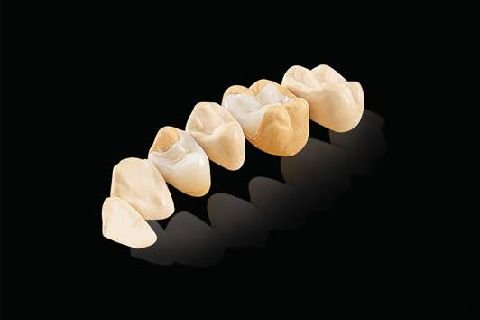 Aesthetic Materials - Our Products - United Dental